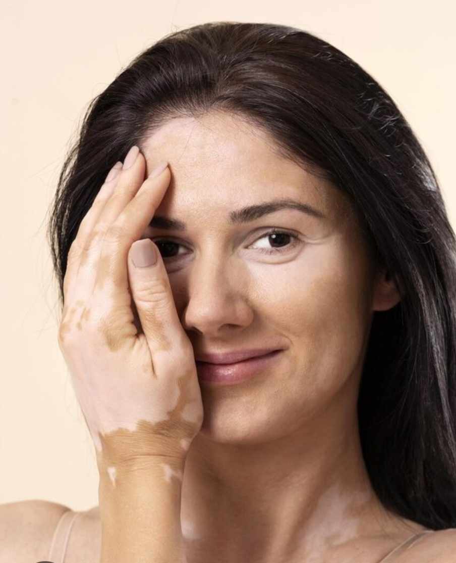 Baltmė | Permanentinio makiažo galimybės - Permanento pasaulis